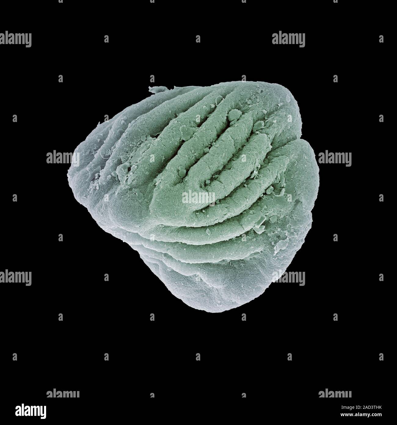 Clam shrimp egg. Coloured scanning electron micrograph (SEM) of the egg ...