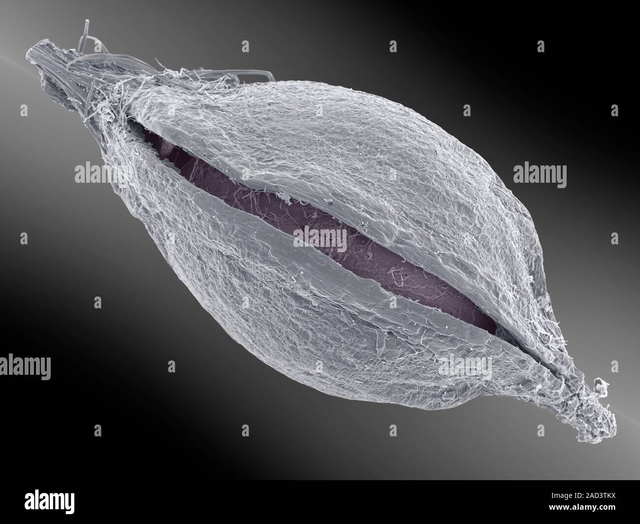 Mountain clover (Trifolium montanum) seed. Coloured scanning electron ...