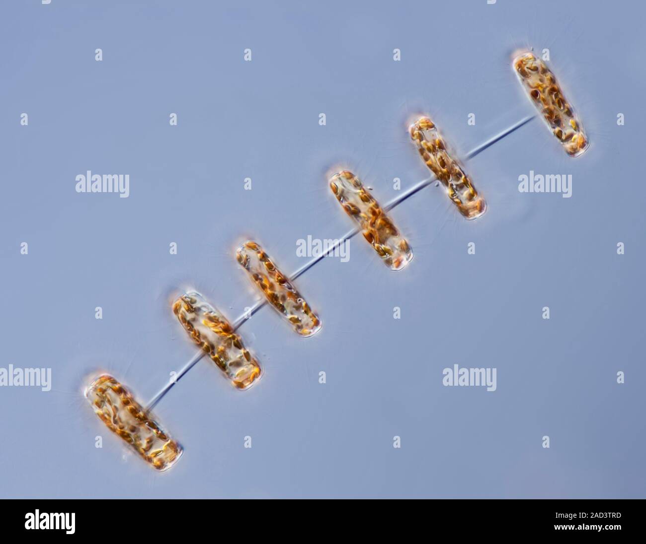 Light micrograph of Thalassiosira sp. (Gr. thalassa, sea & Gr. seira ...