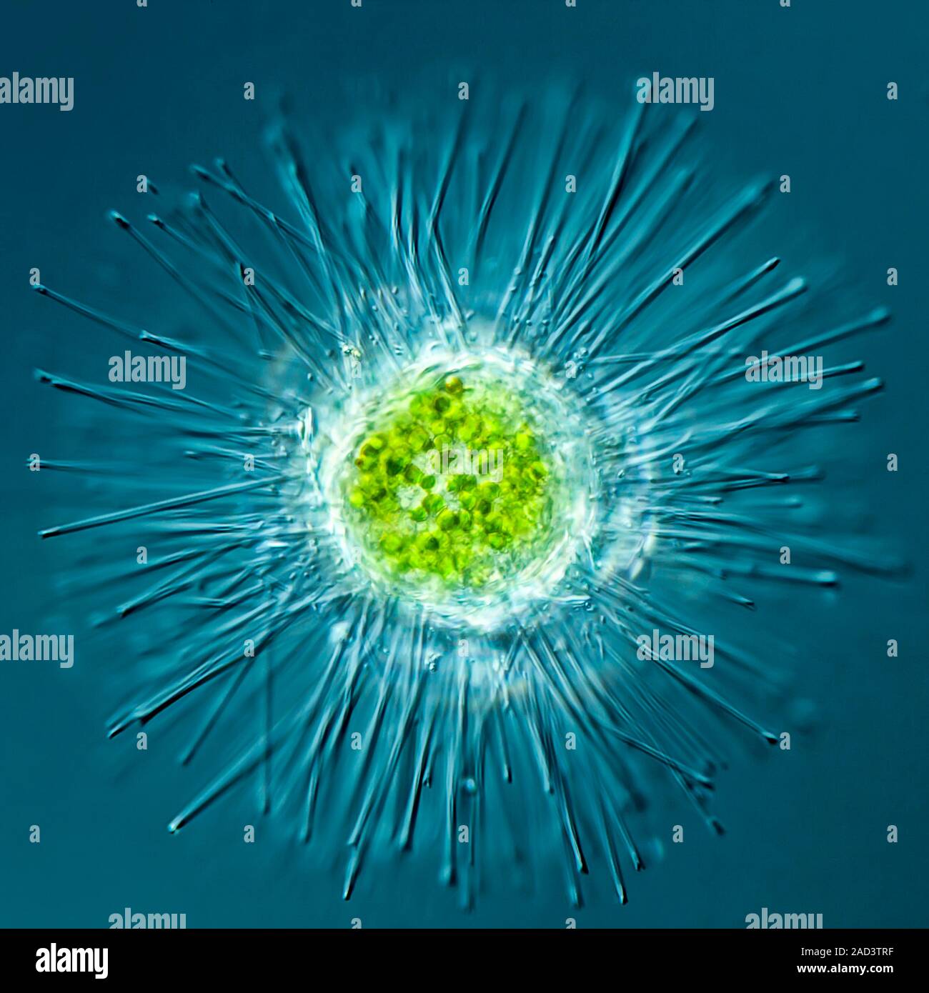 LM of a heliozoon, Acanthocystis turfacea Carter 1863. The green color ...