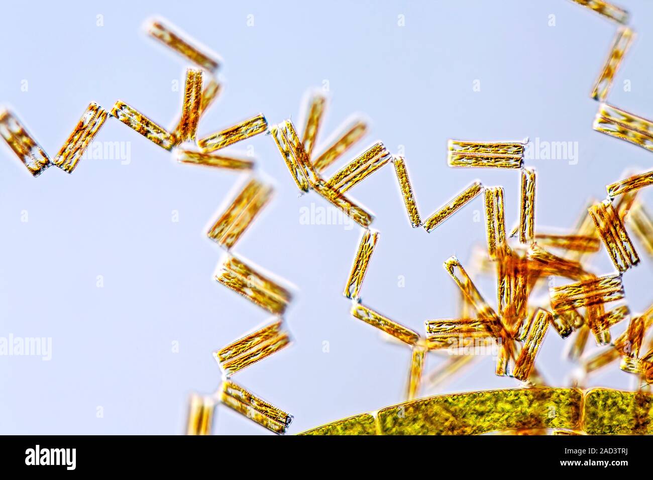 Light micrograph of Diatoma sp. freshwater diatoms attached to a ...