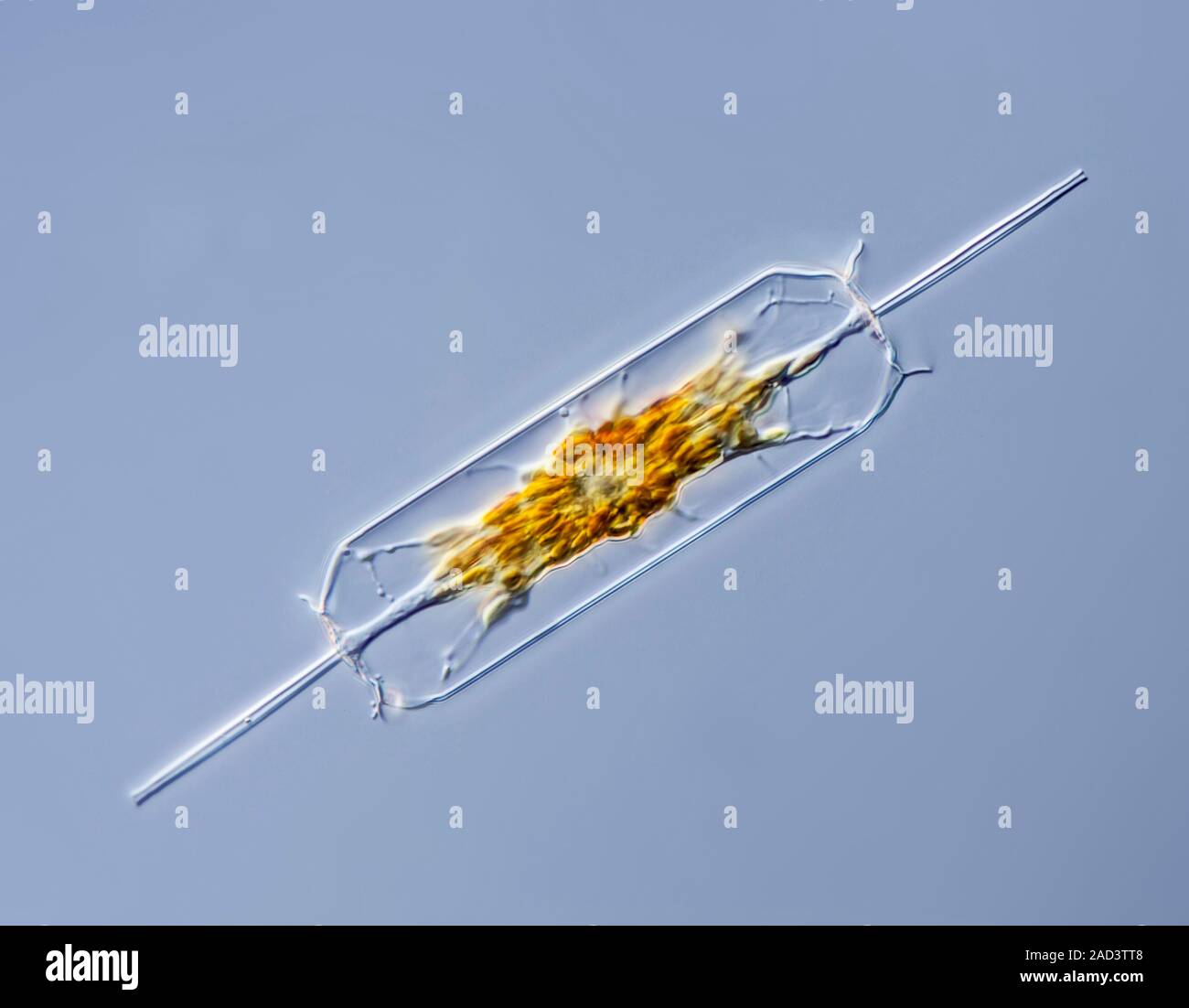 Light micrograph of Ditylum brightwellii, a marine diatom, found in the ...
