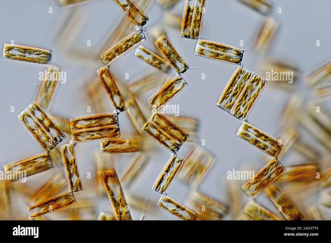 Light micrograph of Diatoma sp. freshwater diatoms attached to a ...