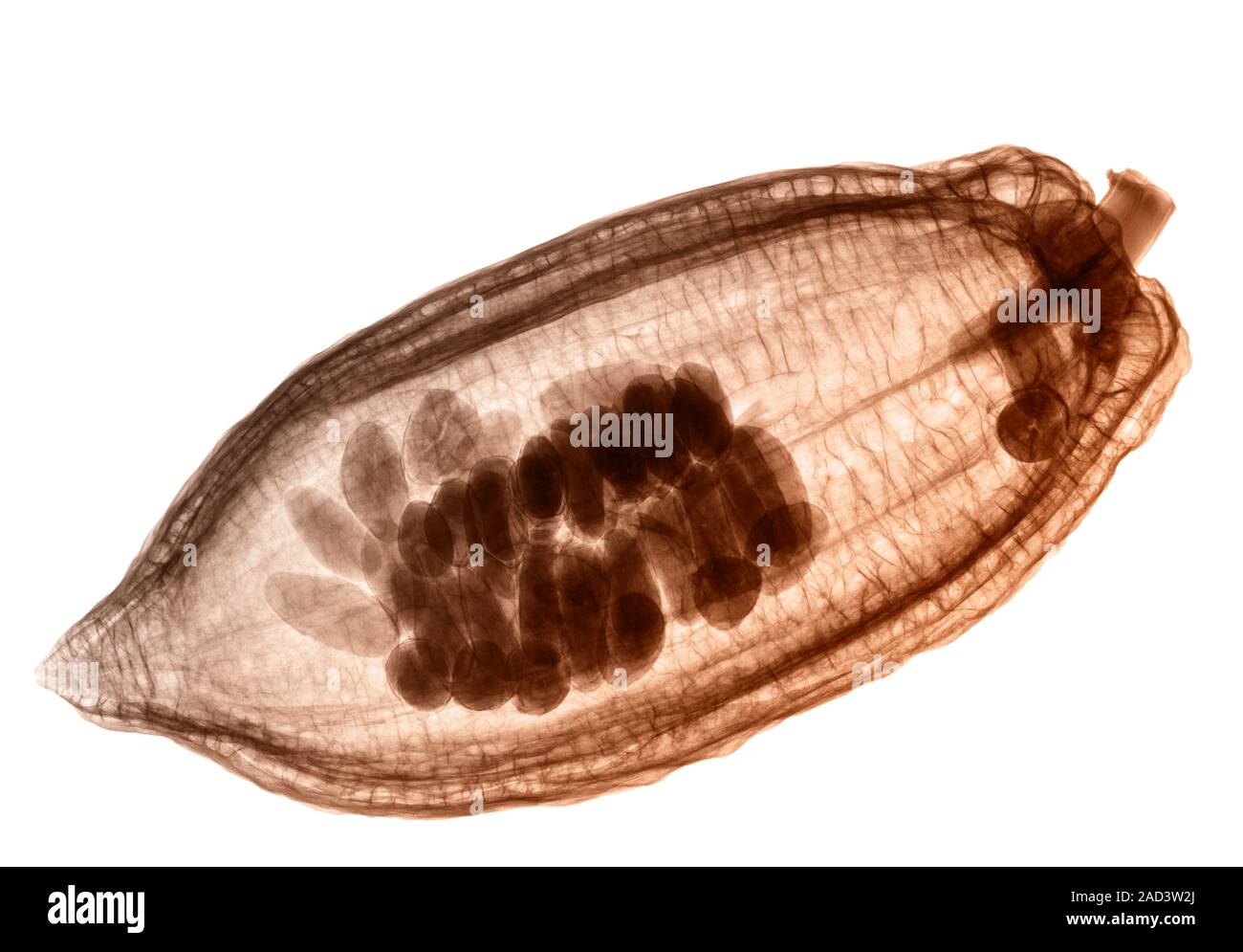 Cocoa pod. Coloured X-ray of the fruit (pod) from a cocoa (Theobroma ...