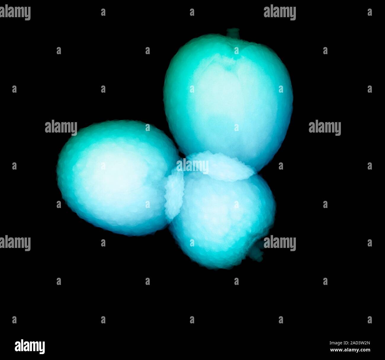 Lychees. Coloured X-ray of fruit from a lychee (Litchi sp.) tree Stock ...
