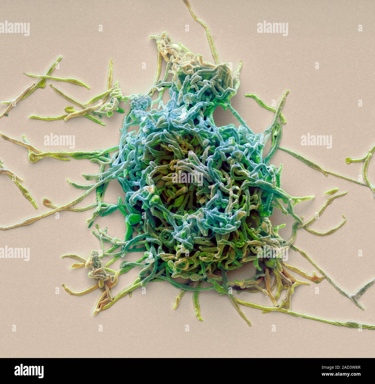 Mycoplasma pneumoniae. Coloured scanning electron micrograph (SEM) of ...