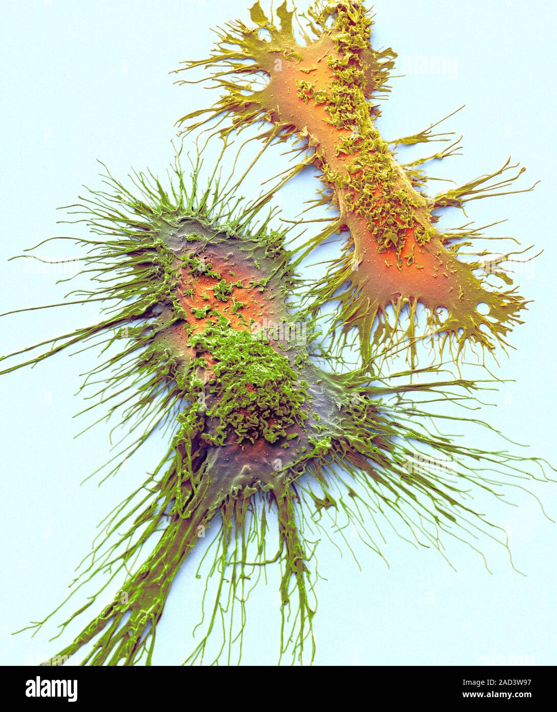 Microglia. Coloured scanning electron micrograph (SEM) of protective ...