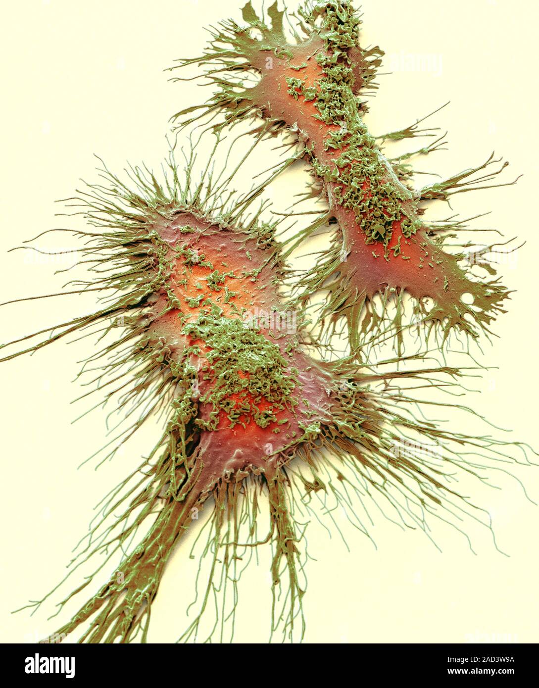 Microglia. Coloured scanning electron micrograph (SEM) of protective ...