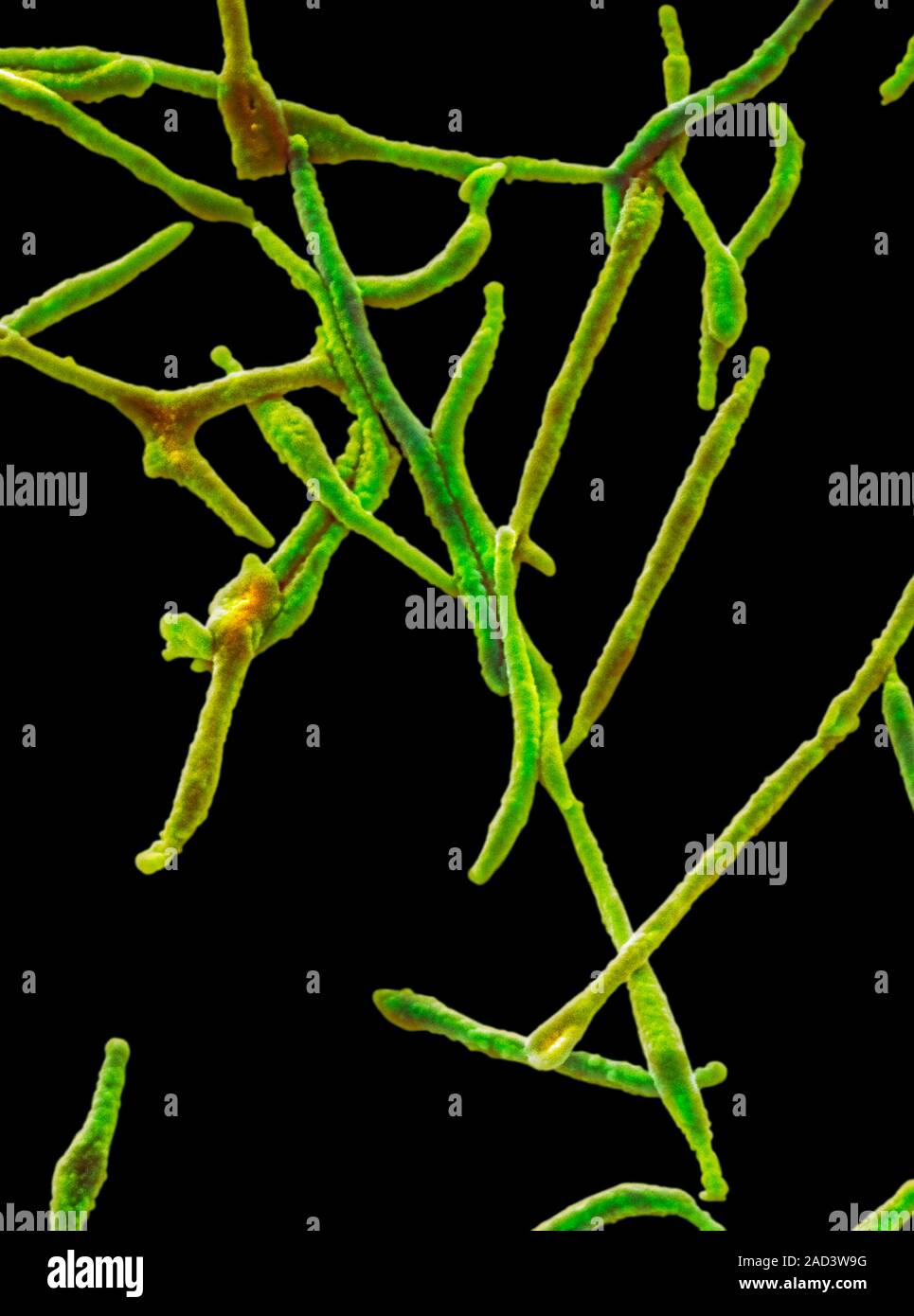 Mycoplasma pneumoniae. Coloured scanning electron micrograph (SEM) of ...