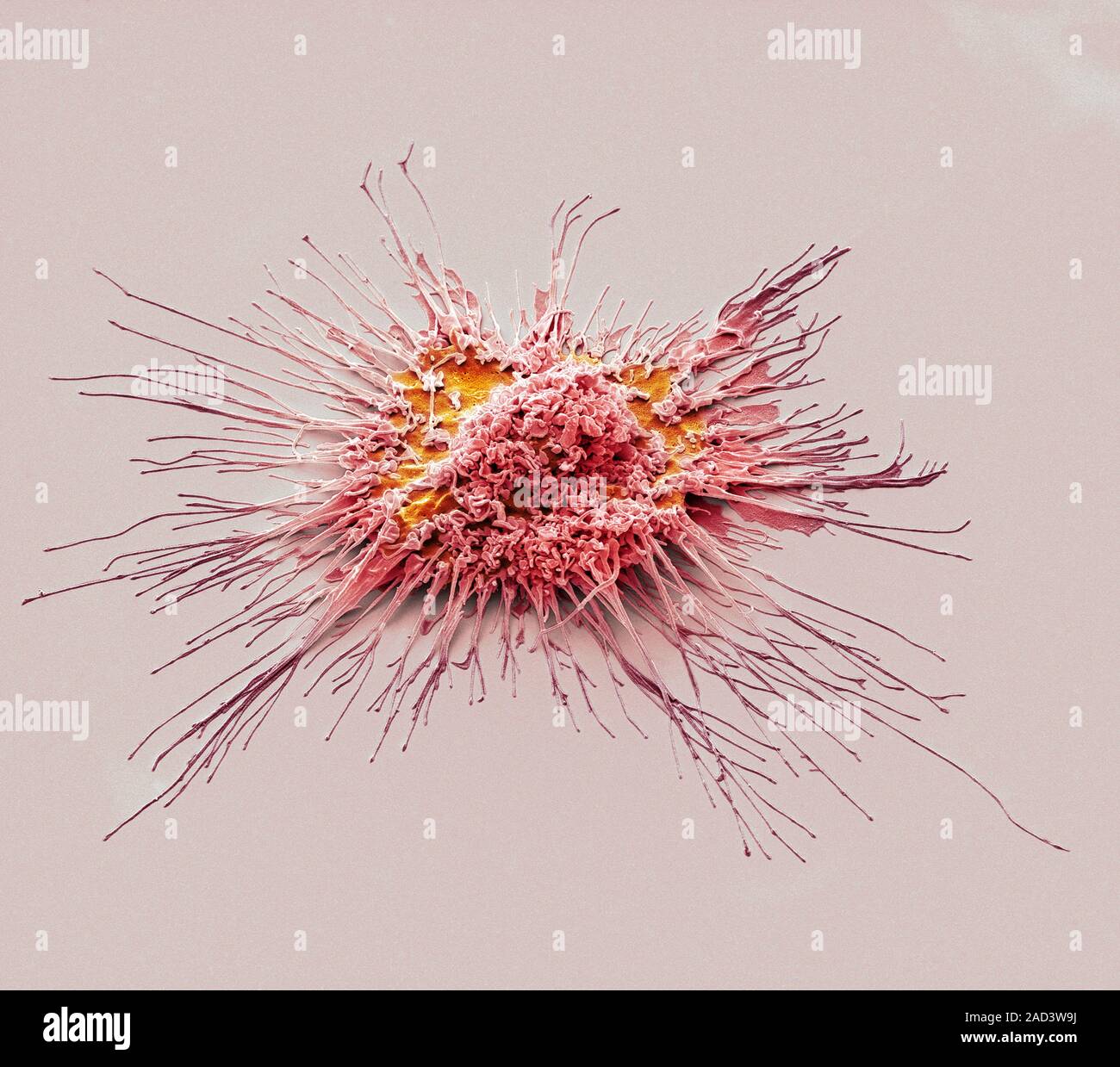 Dendritic cell. Coloured scanning electron micrograph (SEM) of a ...
