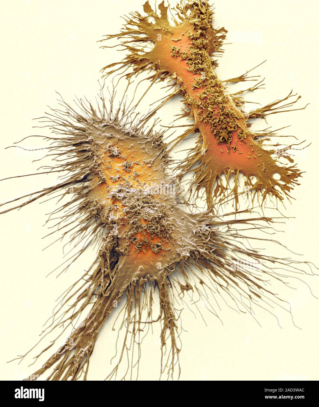 Microglia. Coloured scanning electron micrograph (SEM) of protective ...