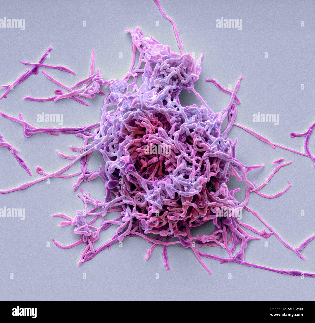 Mycoplasma pneumoniae. Coloured scanning electron micrograph (SEM) of ...