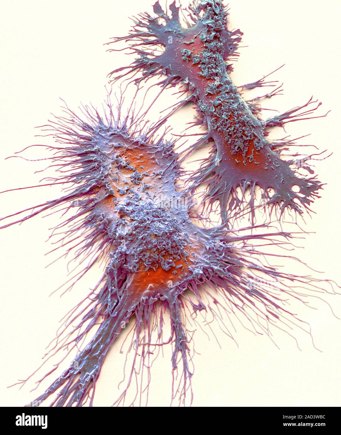 Microglia. Coloured scanning electron micrograph (SEM) of protective ...