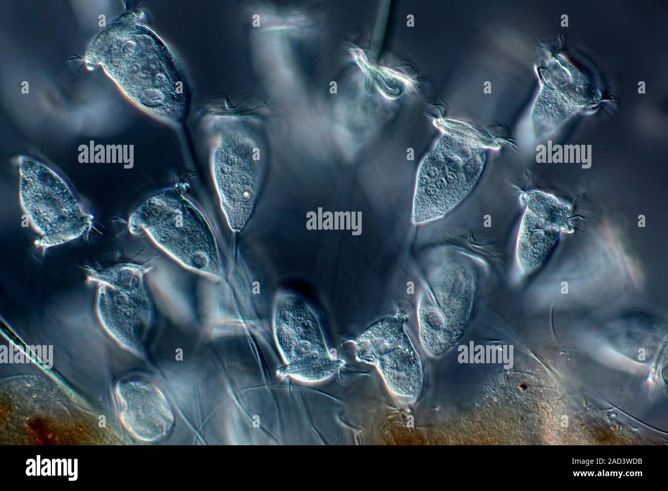 Vorticella protozoa. Differential interference contrast (DIC) light ... Vorticella protozoa. Differential interference contrast (DIC) light ...