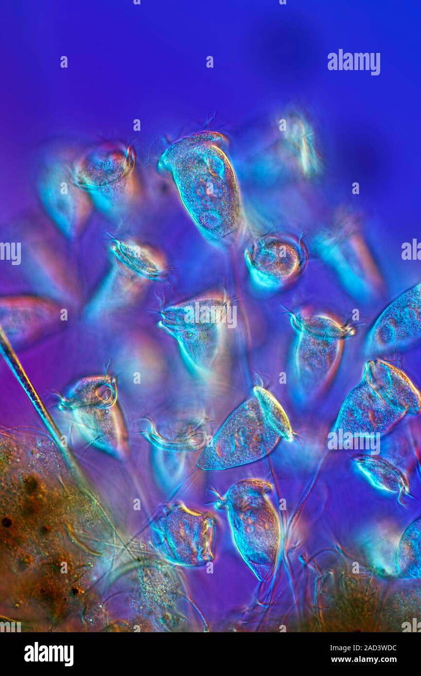Vorticella protozoa. Differential interference contrast (DIC) light ...