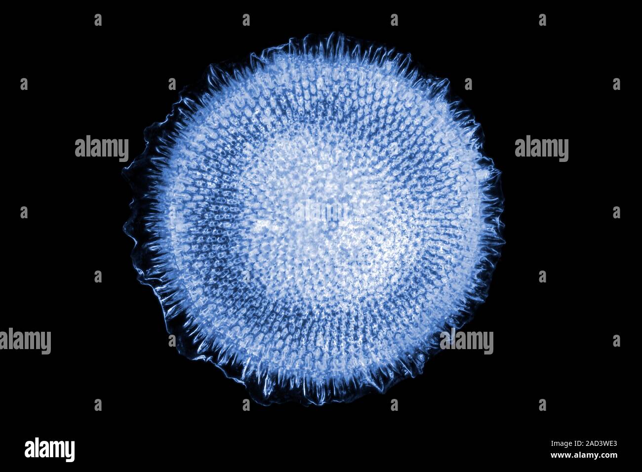Radiolarian protozoan. Darkfield illuminated light micrograph of the ...