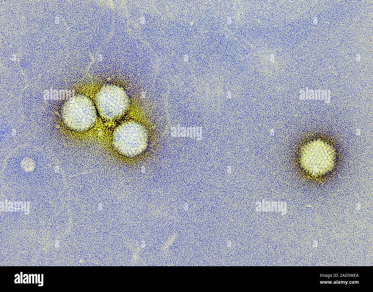 Adenovirus particles. Coloured transmission electron micrograph (TEM ...