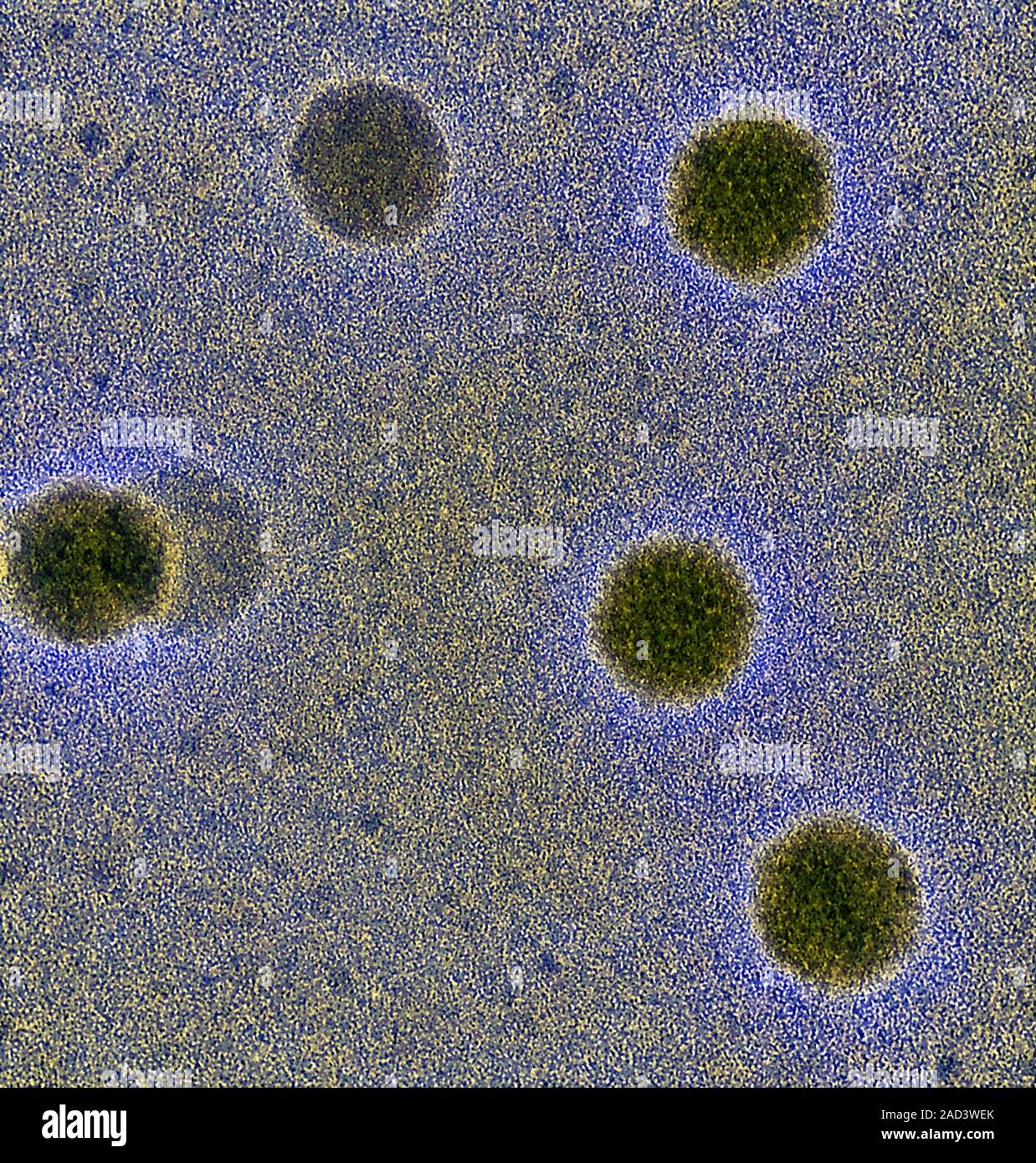Adenovirus particles. Coloured transmission electron micrograph (TEM ...