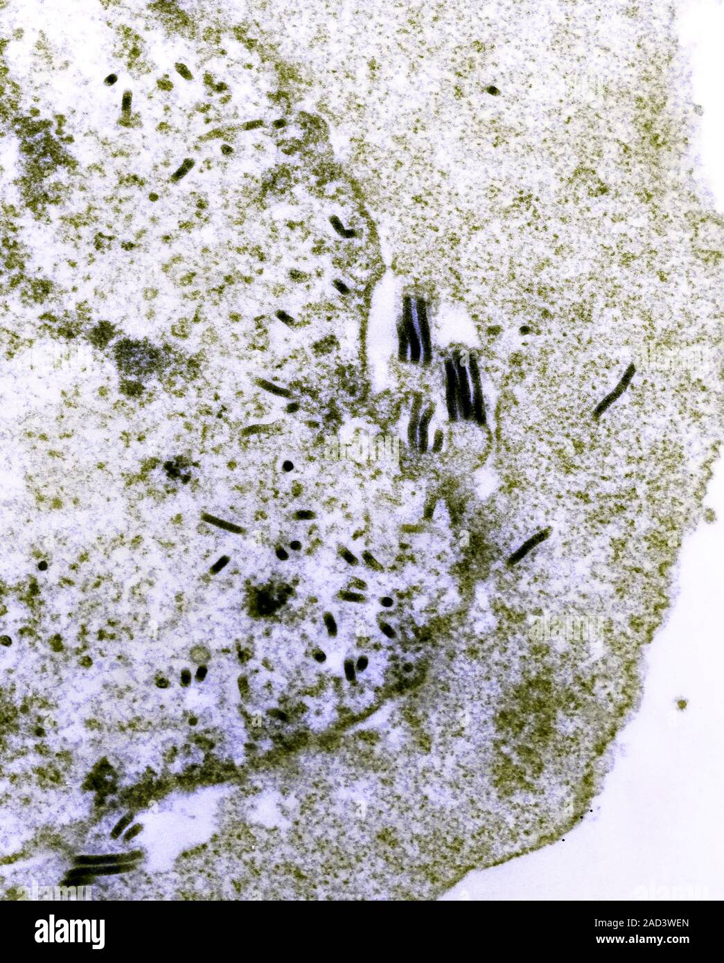 Baculovirus infection. Coloured transmission electron micrograph (TEM ...