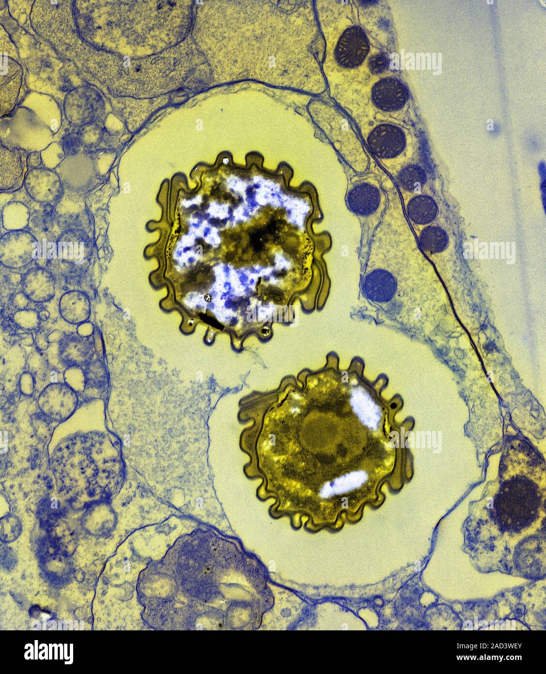 Cryptosporidium infecting tissue. Coloured transmission electron ...