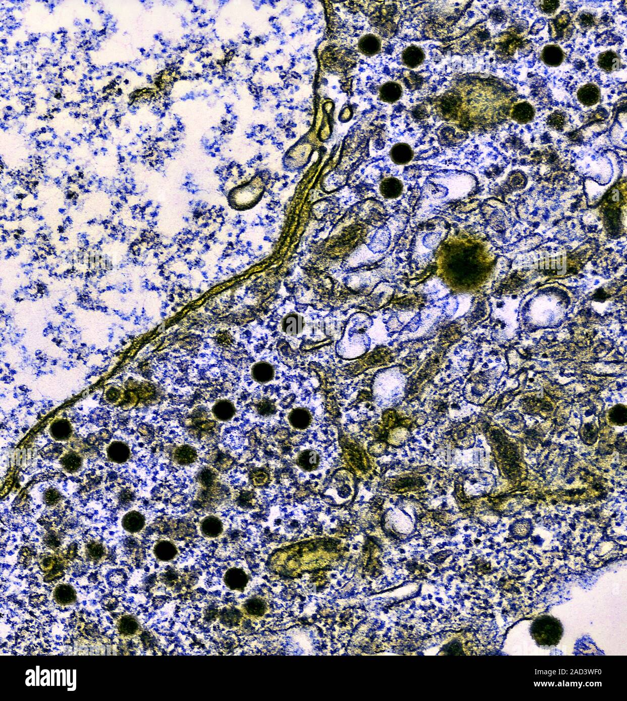 Herpes simplex virus infection. Coloured transmission electron ... Herpes simplex virus infection. Coloured transmission electron ...