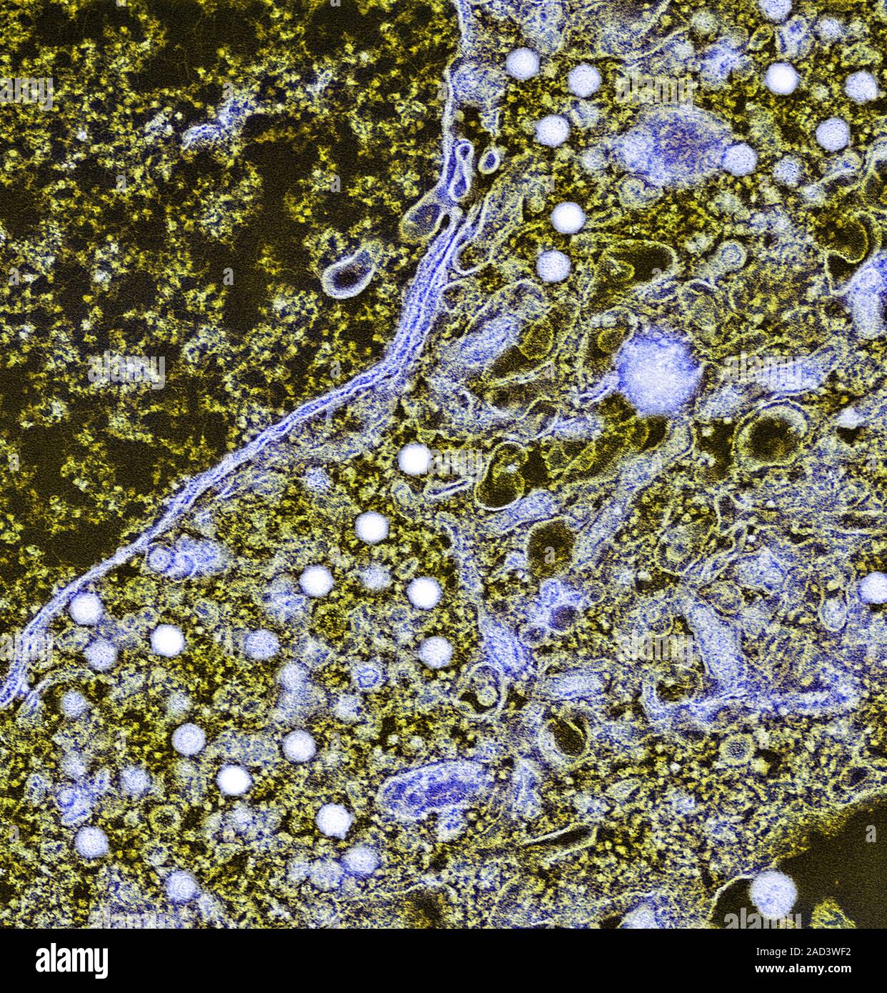 Herpes simplex virus infection. Coloured transmission electron ...