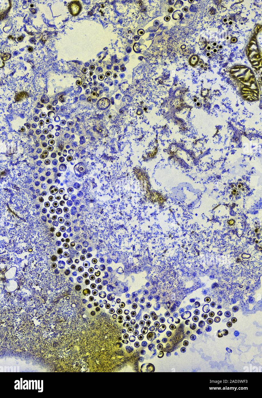 Herpes simplex virus infection. Coloured transmission electron ...