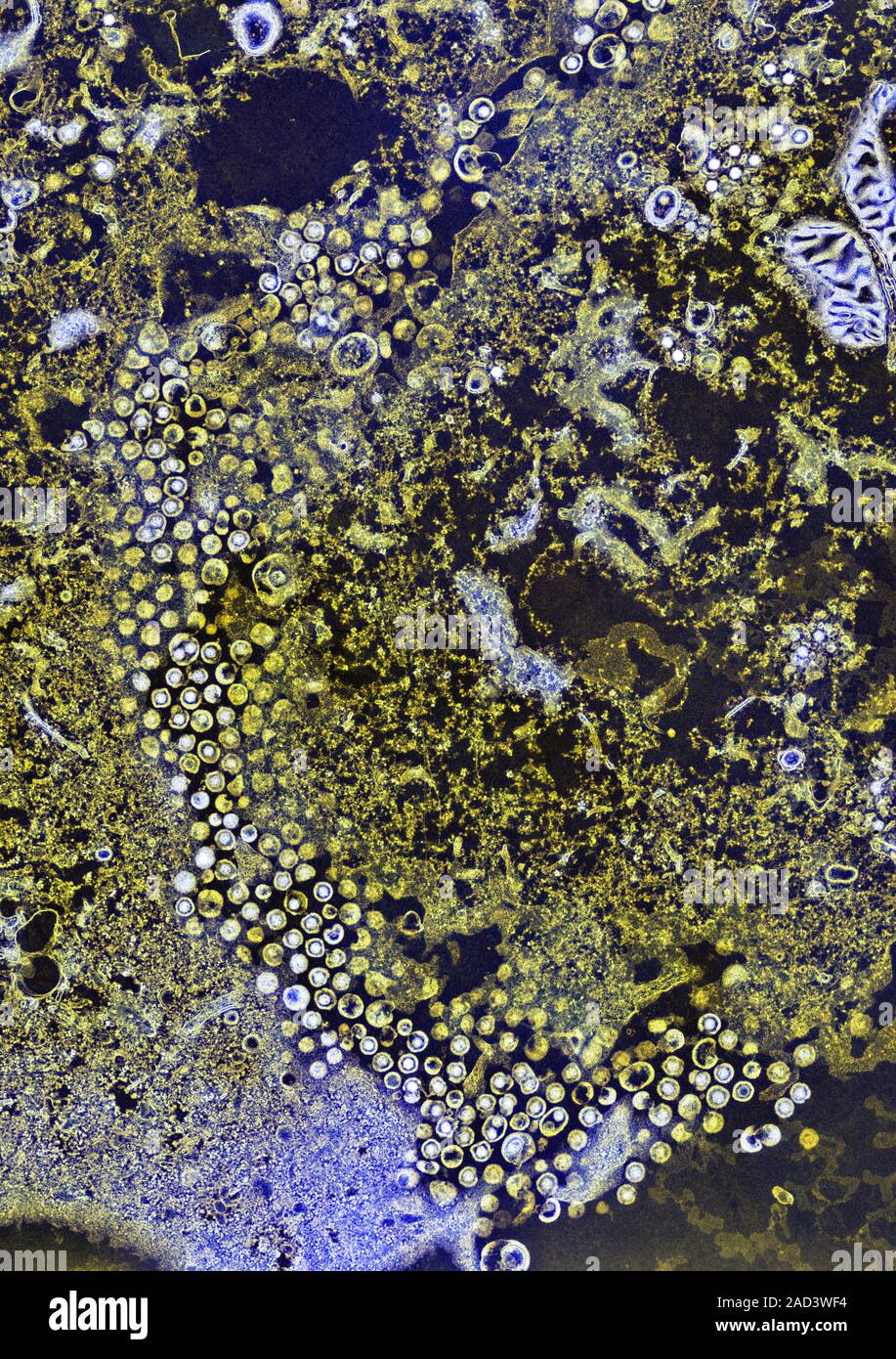 Herpes simplex virus infection. Coloured transmission electron ...