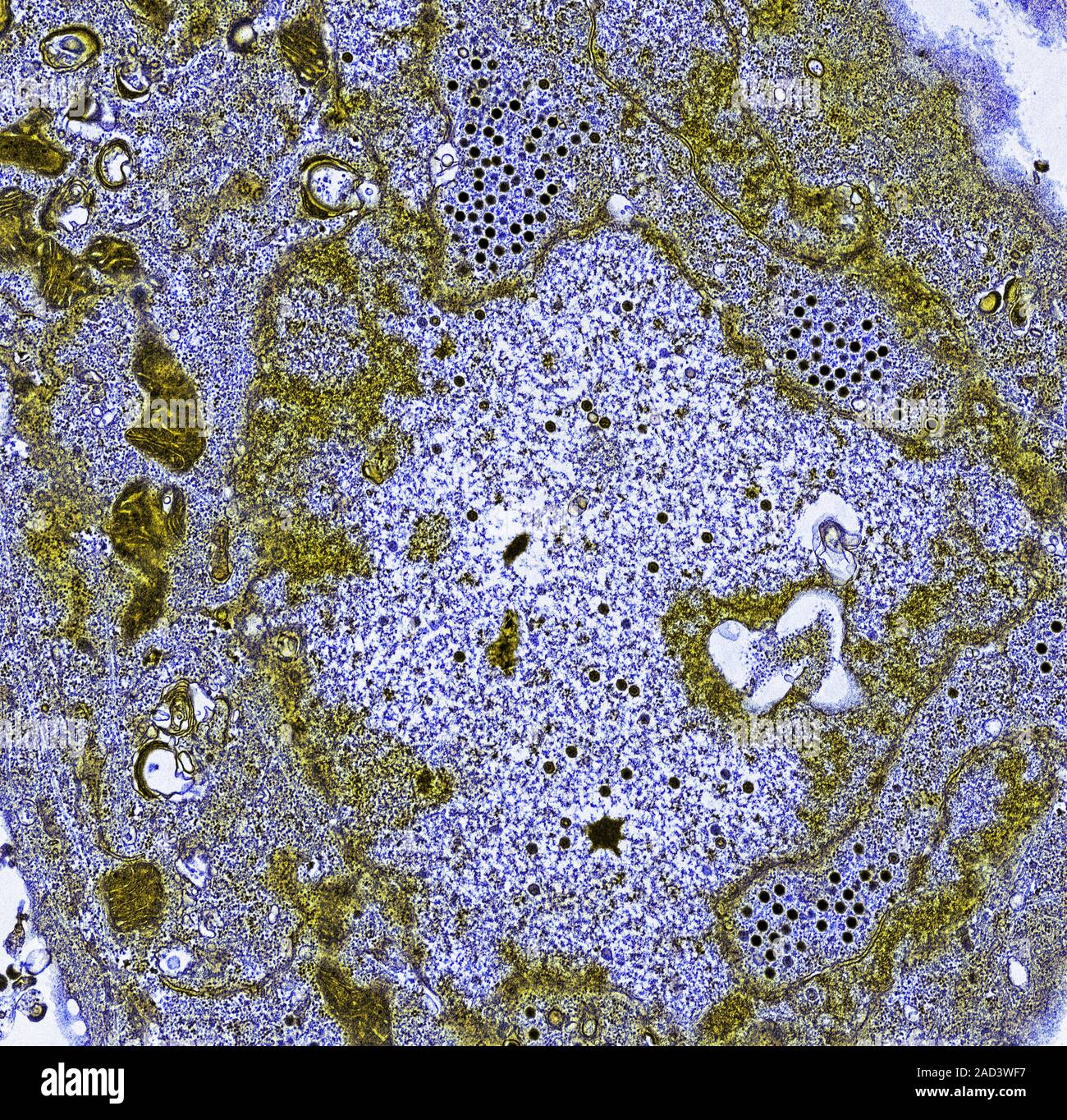 Herpes simplex virus infection. Coloured transmission electron ...