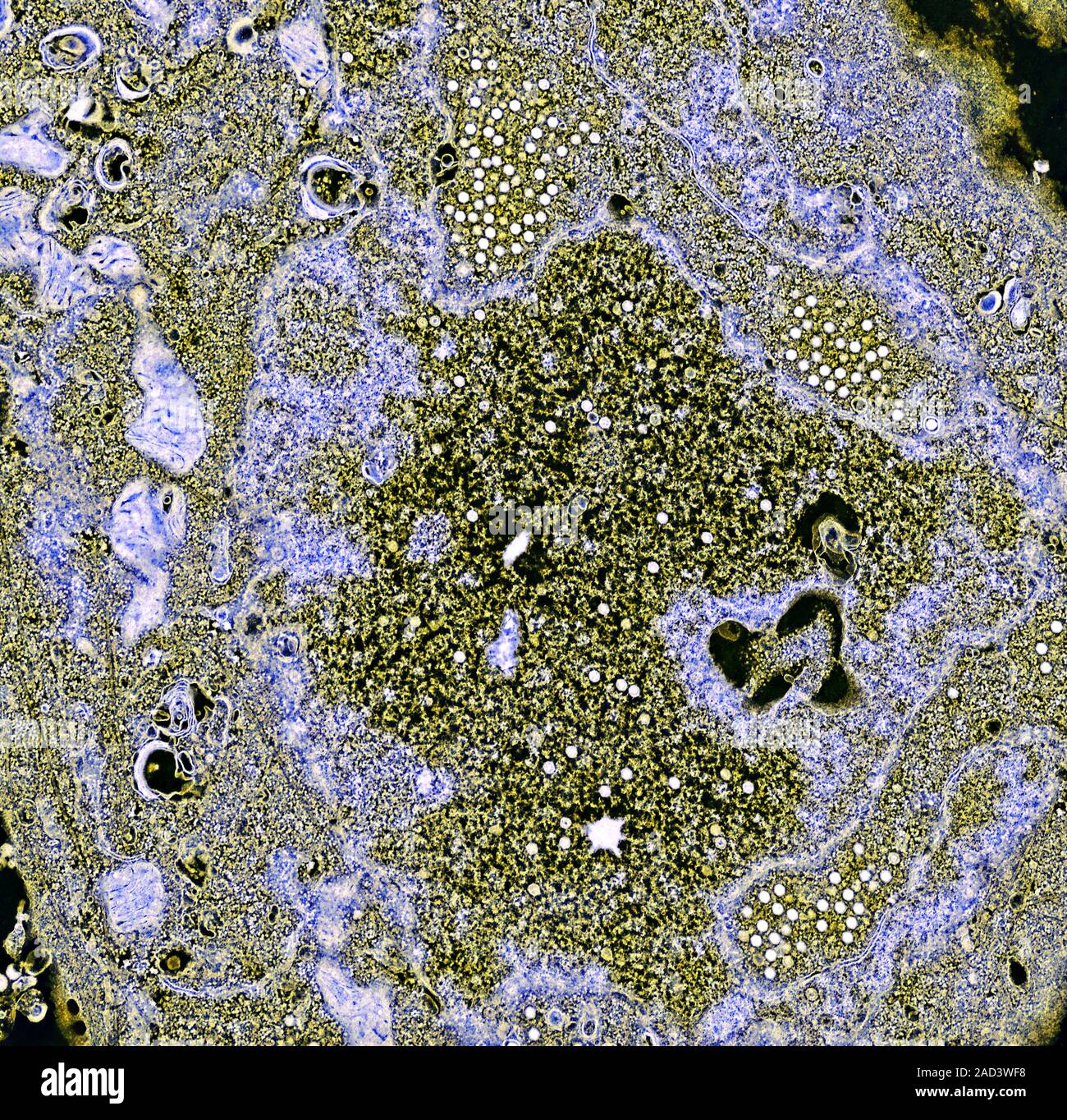 Herpes simplex virus infection. Coloured transmission electron ...