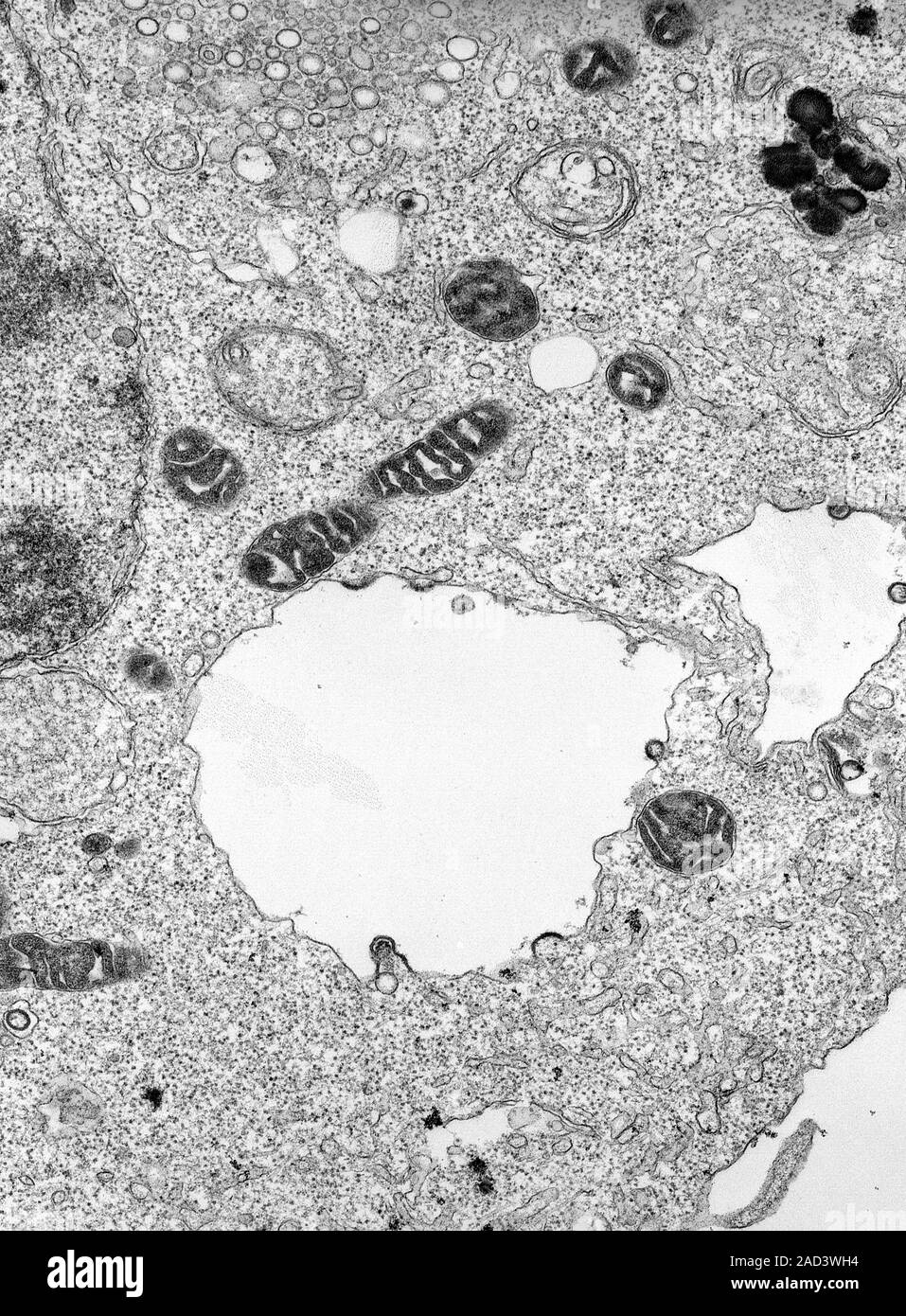 HIV infection. Transmission electron micrograph (TEM) of a section ...