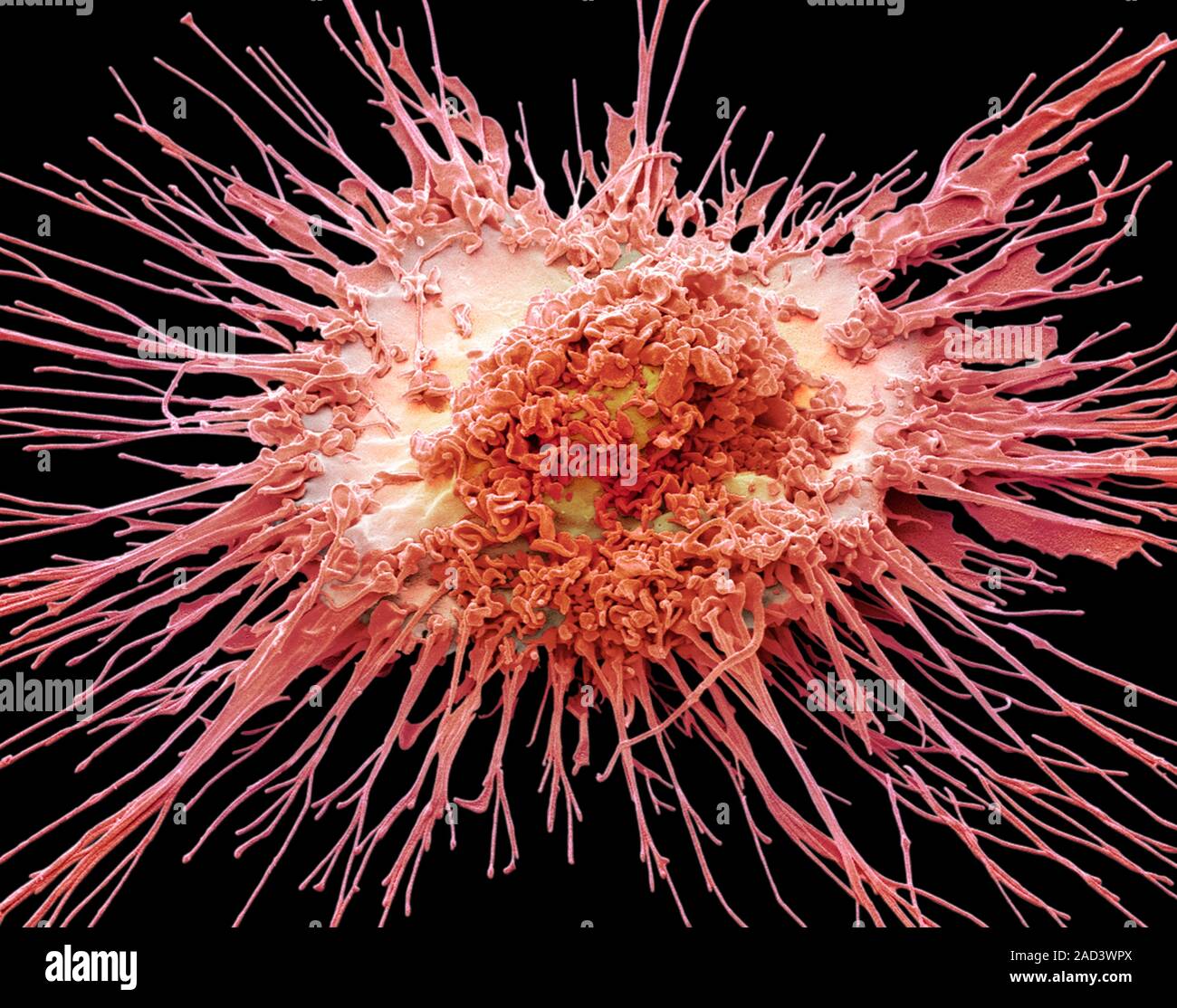 Dendritic cell. Coloured scanning electron micrograph (SEM) of a ...