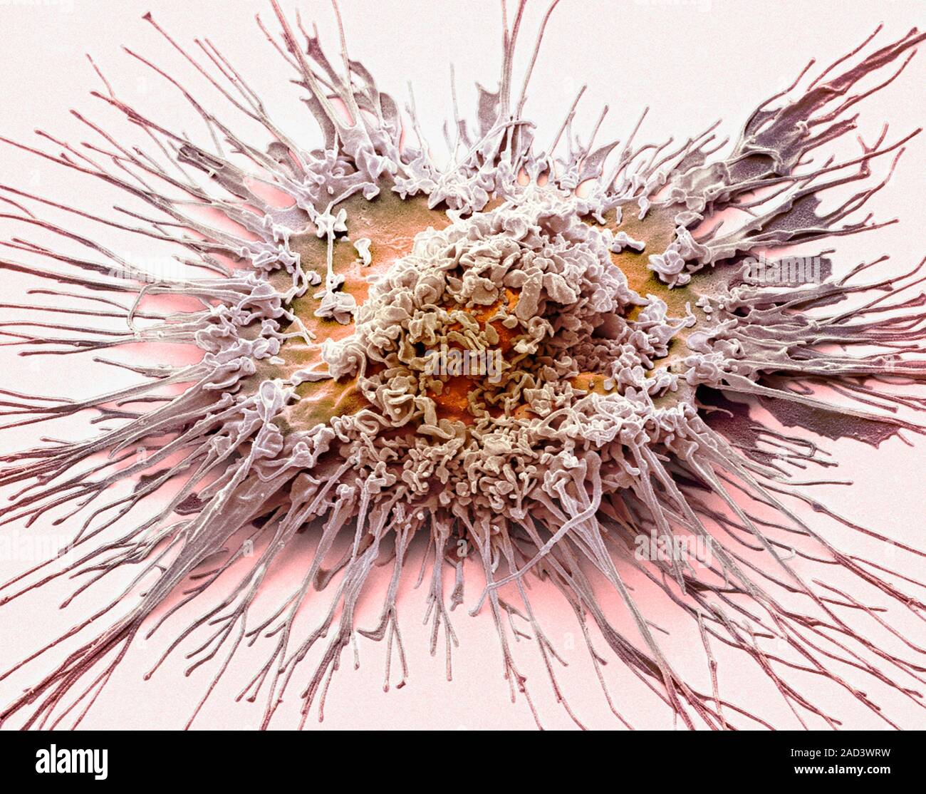 Dendritic cell. Coloured scanning electron micrograph (SEM) of a ...