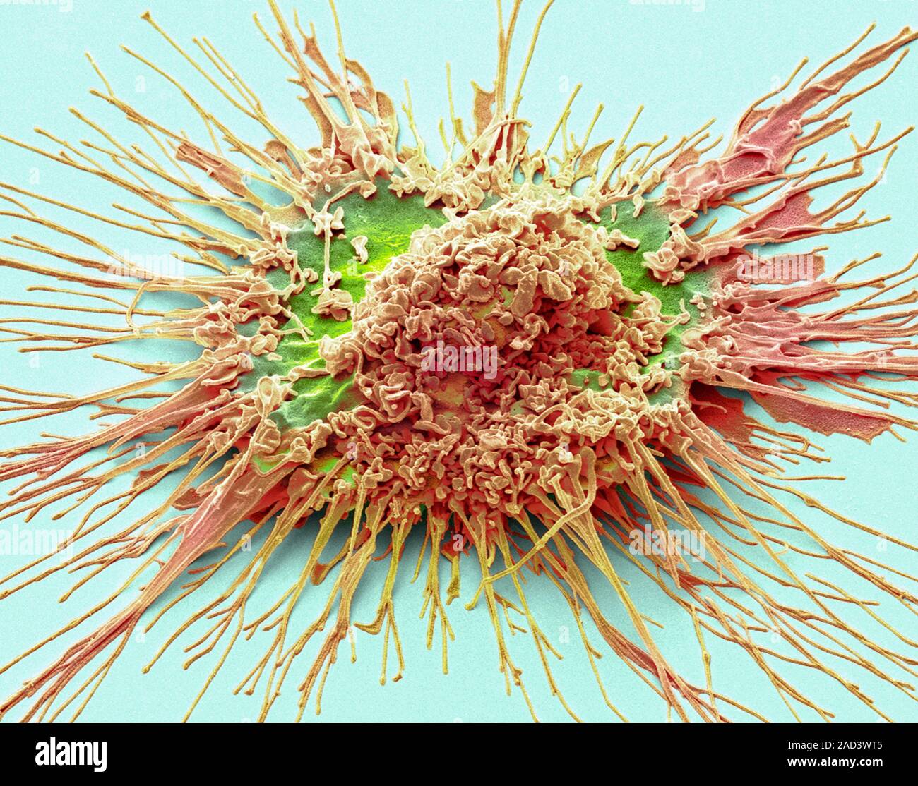 Dendritic cell. Coloured scanning electron micrograph (SEM) of a ...