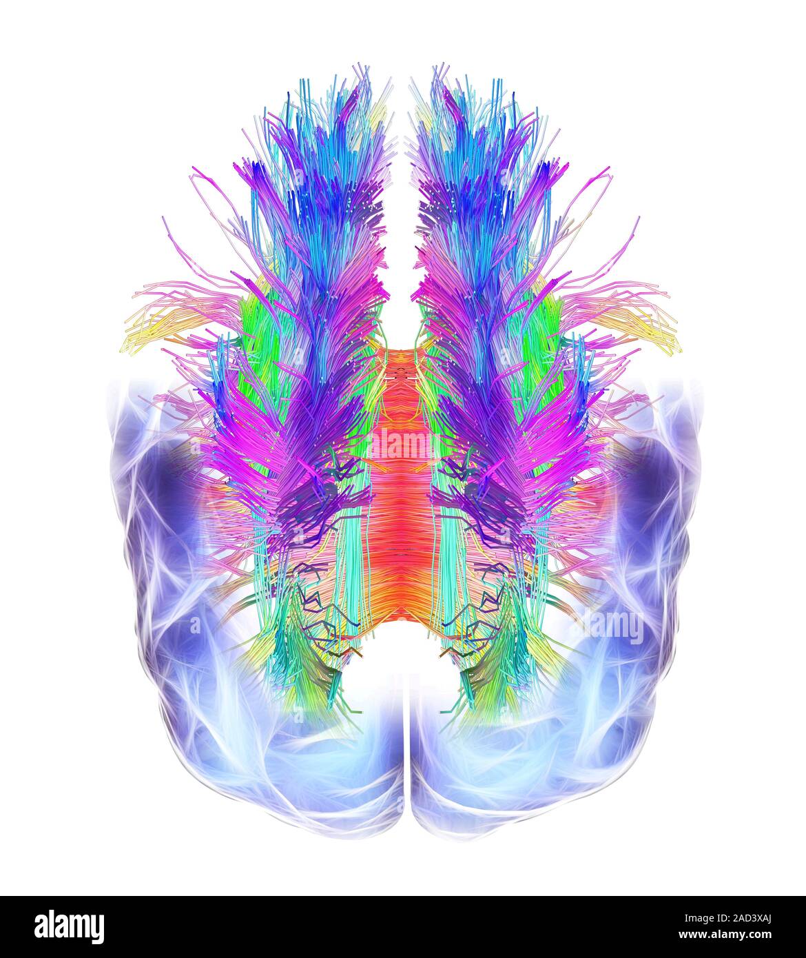 White matter fibres overlaid a 3d model of the human brain in top view ...