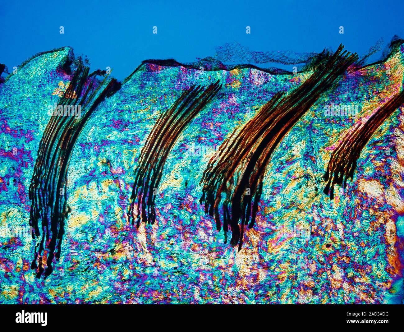 Polarised light micrograph of a transverse section of the skin of a ...