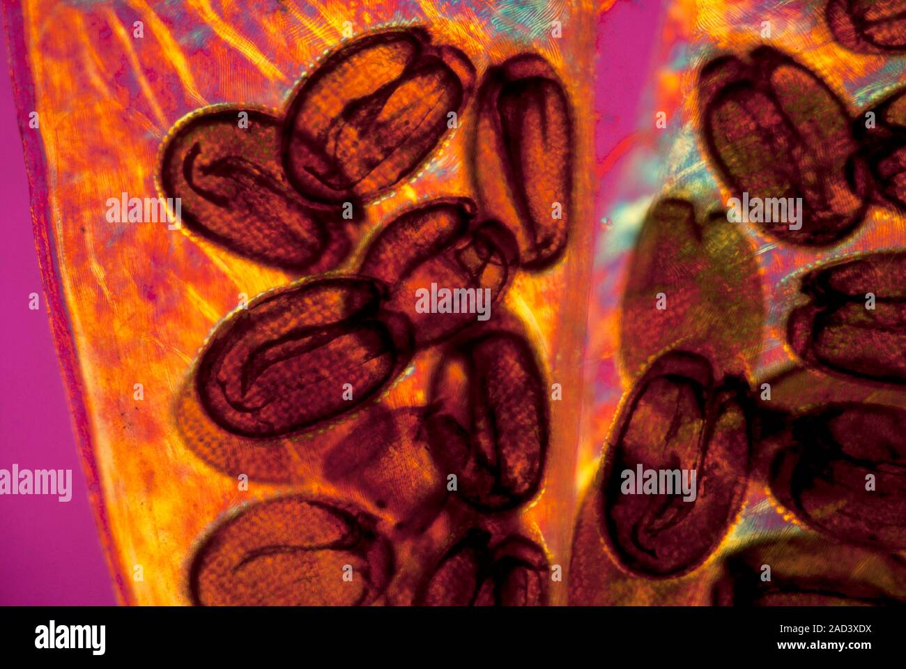 Polarised light micrograph of the seed pod of Capsella bursa-pastoris ...