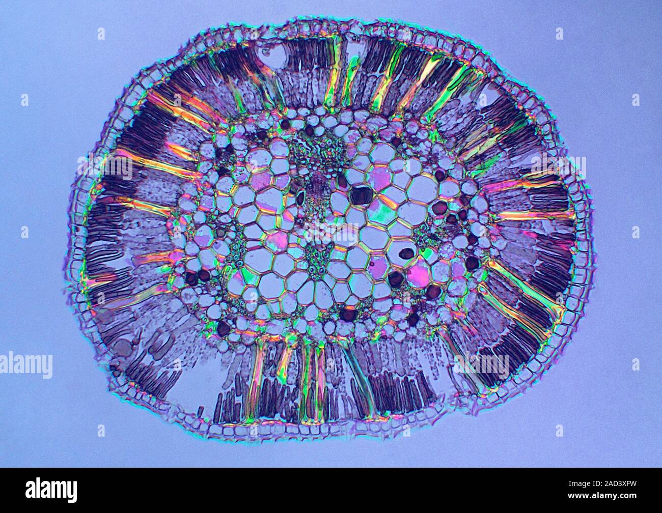 Polarised Light Micrograph Of A Transverse Section Of The Leaf Of The Australian Xerophyte Hakea