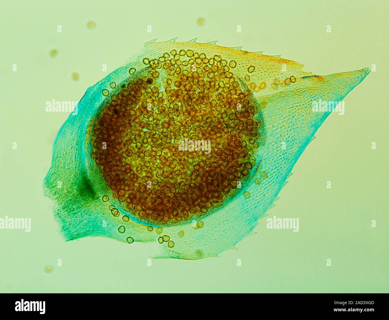 Polarised light micrograph of the microsporangium of Selaginella ...
