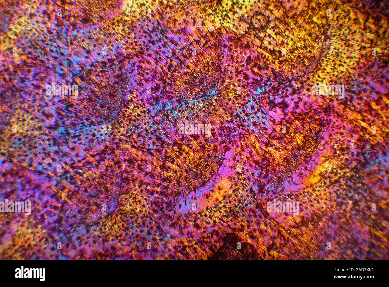Polarised light micrograph of the skin of the common sole (Solea solea ...
