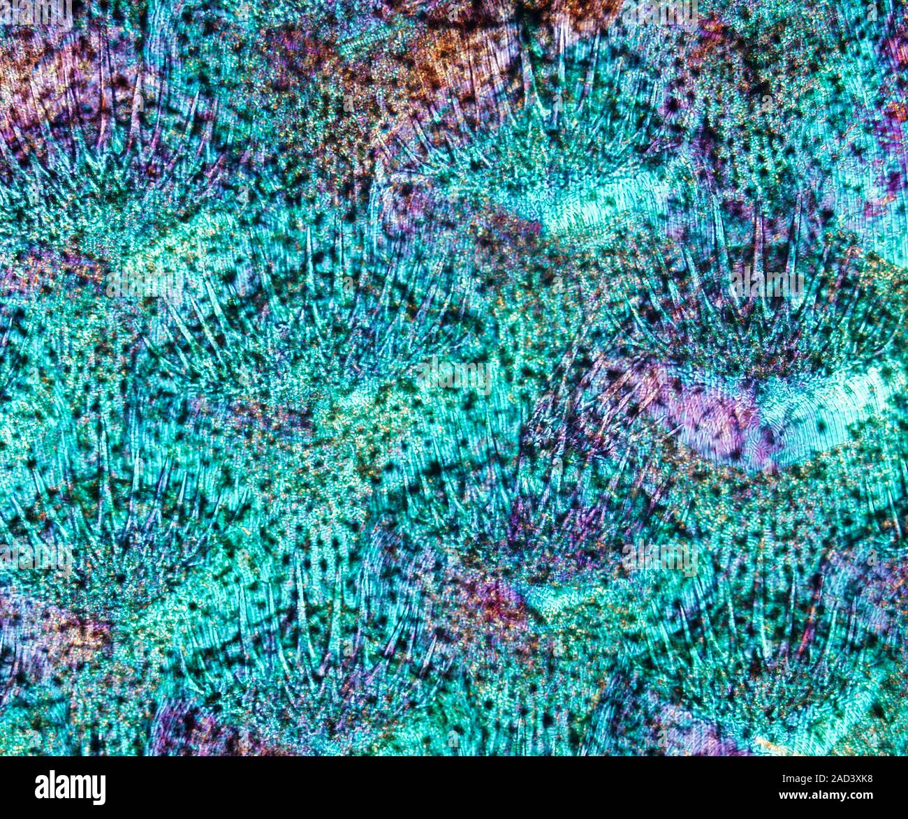 Polarised light micrograph of the skin of the common sole (Solea solea ...