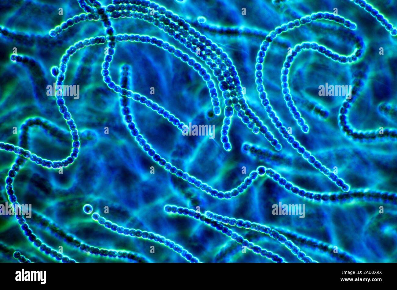 Nostoc cyanobacteria. Darkfield illuminated polarised light micrograph ... Nostoc cyanobacteria. Darkfield illuminated polarised light micrograph ...