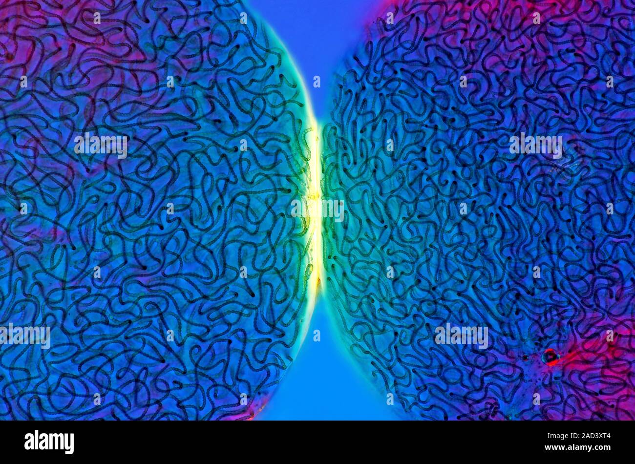 Nostoc cyanobacteria. Polarised light micrograph of two spherical ...