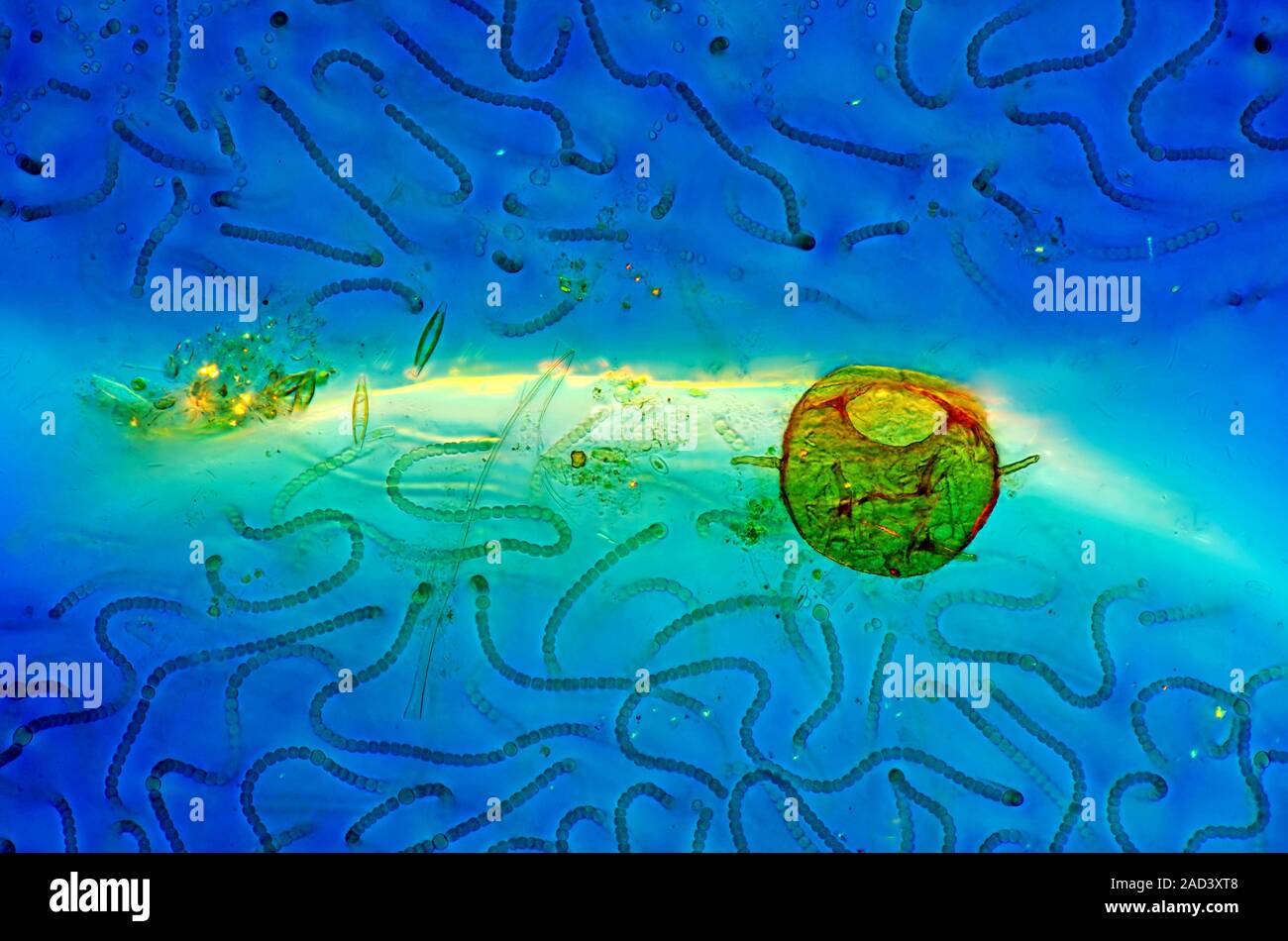 Cyanobacteria and amoeba. Polarised light micrograph of two spherical ...