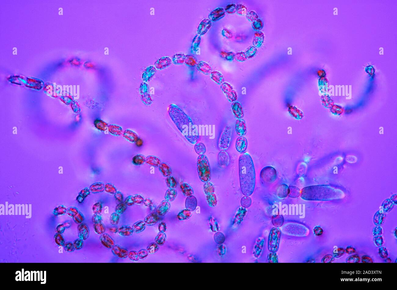 Anabaena cyanobacteria. Polarised light micrograph of filamentous ...
