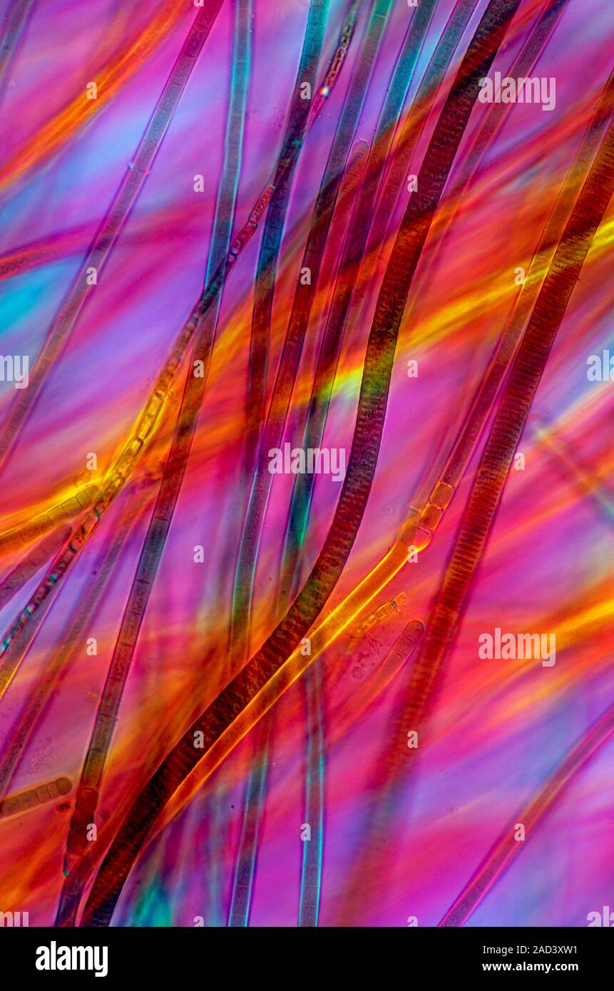 Oscillatoria cyanobacteria. Polarised light micrograph of filamentous ...