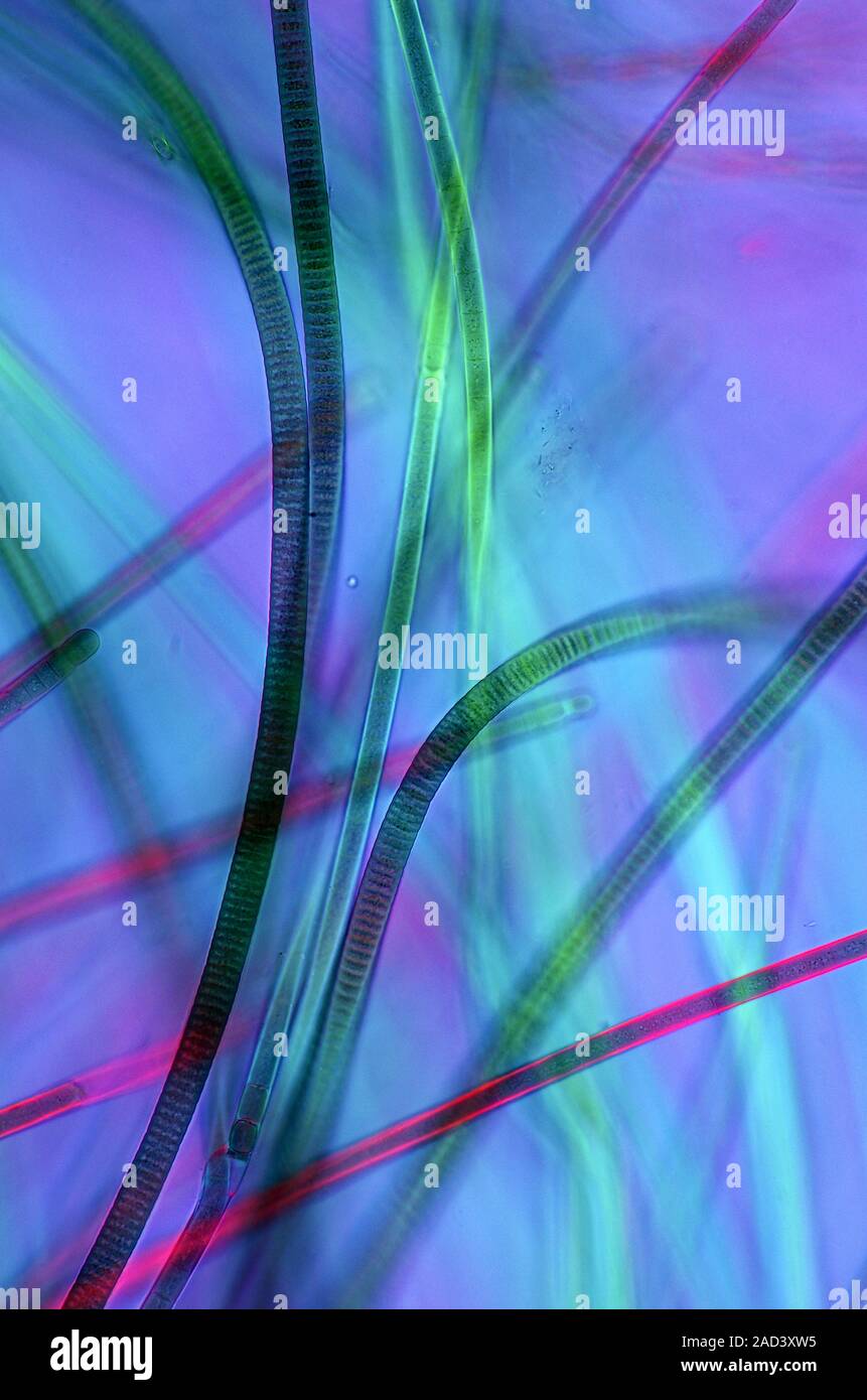 Oscillatoria cyanobacteria. Polarised light micrograph of filamentous ...