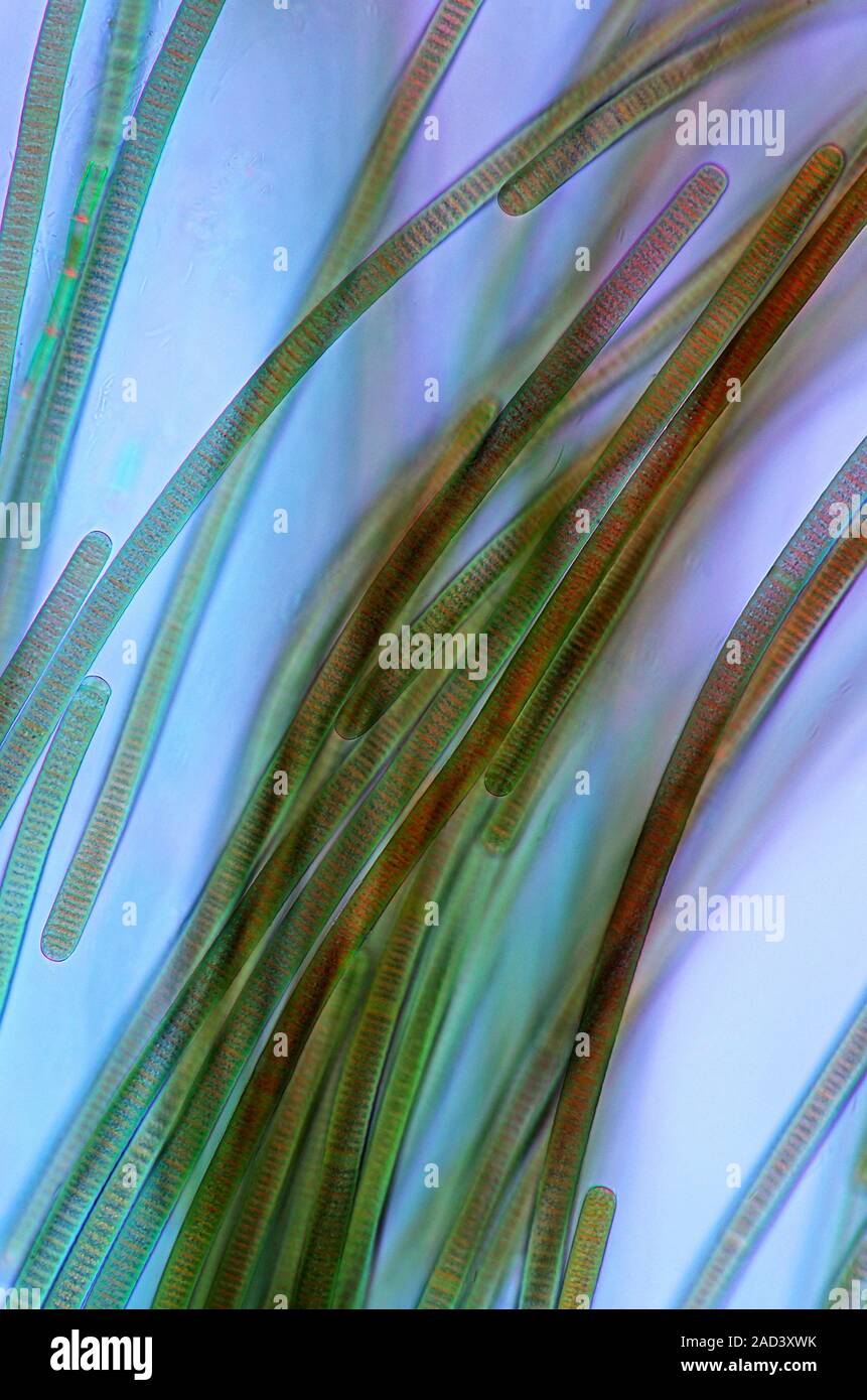 Oscillatoria cyanobacteria. Polarised light micrograph of filamentous colonies of Oscillatoria ...