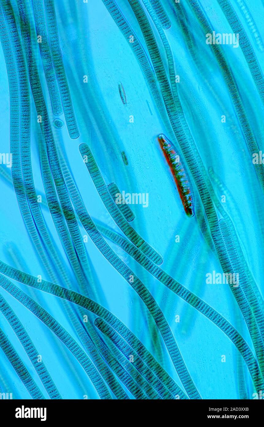 Oscillatoria cyanobacteria. Polarised light micrograph of filamentous ...