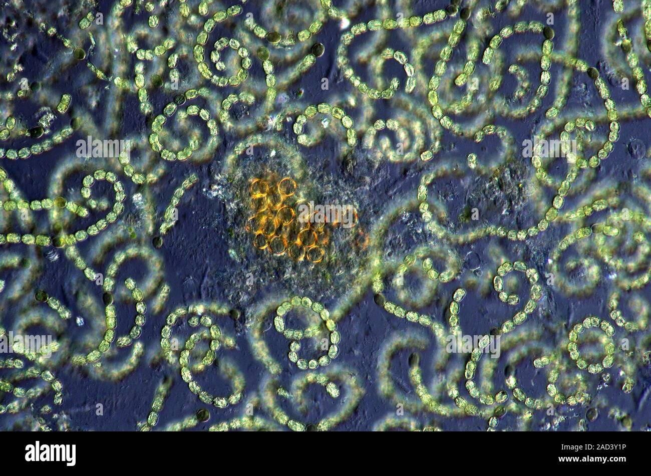 Anabaena cyanobacteria. Polarised light micrograph of filamentous ...